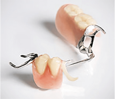 Algemene tandheelkunde - Tandartspraktijk Kieskeurig